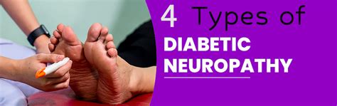 Types Of Diabetic Neuropathy