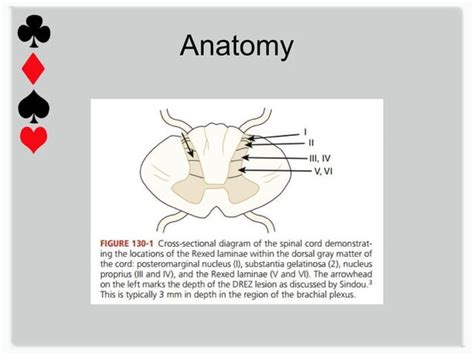 171andsch Ch130 Dorsal Root Entry Zone Lesion Drez Ppt