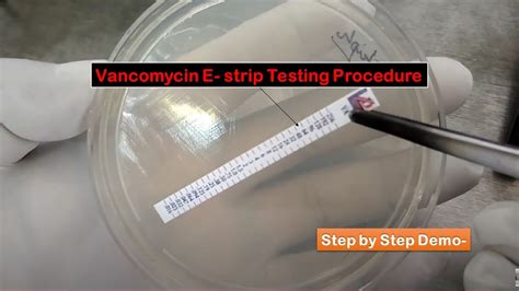 Vancomycin Blood Test Levels At Alica Morgan Blog