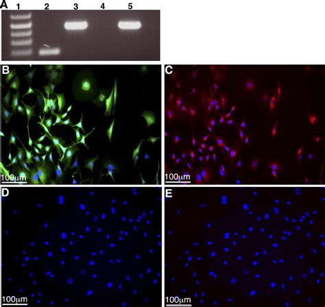 Production Of Insulin Mrna And Protein By Msc Ehi Zs Or Msc 1 Cells