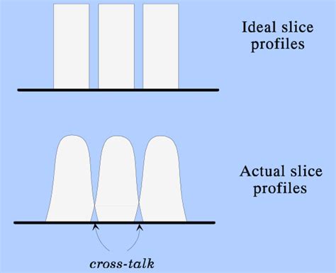 Slice Cross Talk Questions And Answers In Mri
