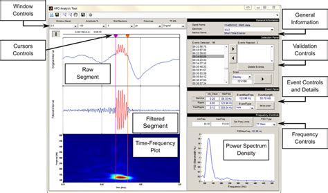 Hfo Analysis Tool Window For Validation Of Detected Hfos The Electrode