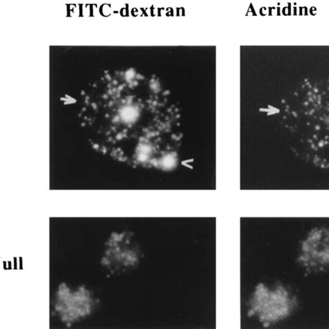 fd accumulates in mutant cells in small lysosome like vesicles control