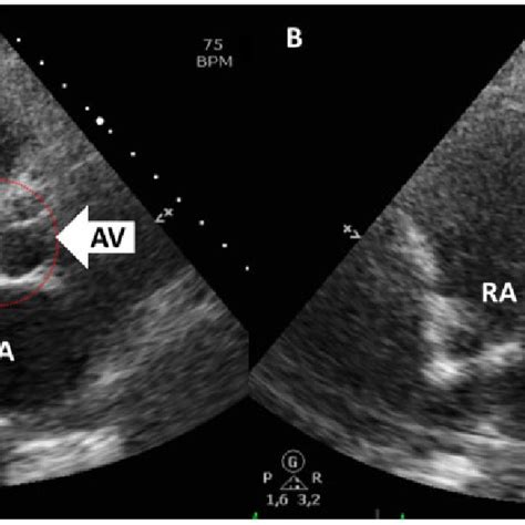Pathogenesis And Possible Clinical Consequences Of Non Bacterial Download Scientific Diagram