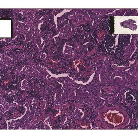 Low Power Overview Showing Dip And Rb Ild With Adjacent Normal But Download Scientific Diagram