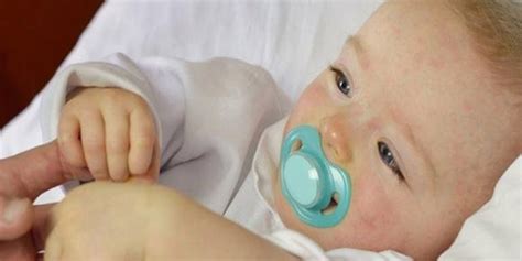 Sesta Malattia Nei Bambini Sintomi Incubazione E Contagio