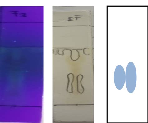 Tlc Results Of The Ethyl Acetate Fraction Of Moringa Leaf Extract With