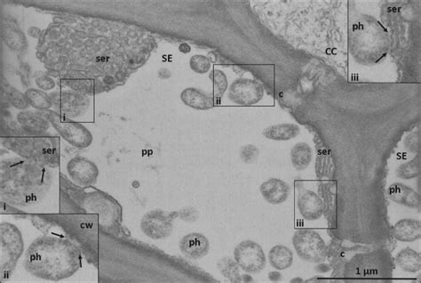 A Combined Microscopy Approach To Study Plantphytoplasma Interaction Using Arabidopsis Thaliana