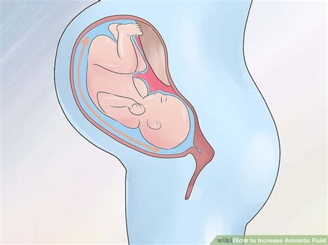 3 Ways To Increase Amniotic Fluid Wikihow