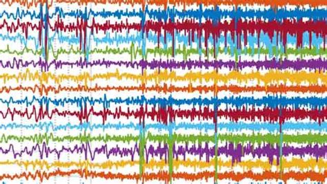 Using Machine Learning To Predict Epileptic Seizures From Eeg Data