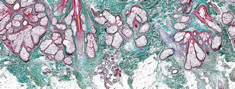 Skin Dermis And Hypodermis — Botanical Formulations