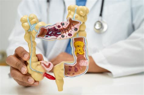 Intestine Appendix And Digestive System Doctor Holding Anatomy Model