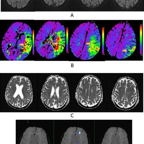 Comparison Between Pwidwi Mismatch And Swi And Diffusion Mismatch