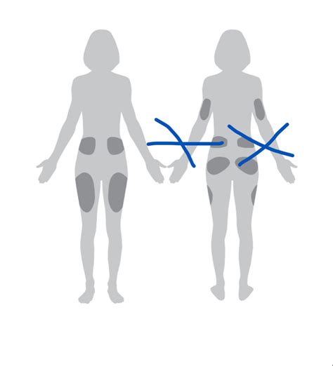 Omnipod Diabetes Diabeties Sugar Disease