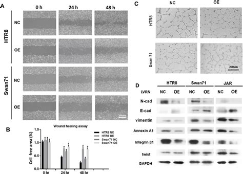 Lvrn Decreased Motility And Inhibited Emt A Wound Healing Assay Of
