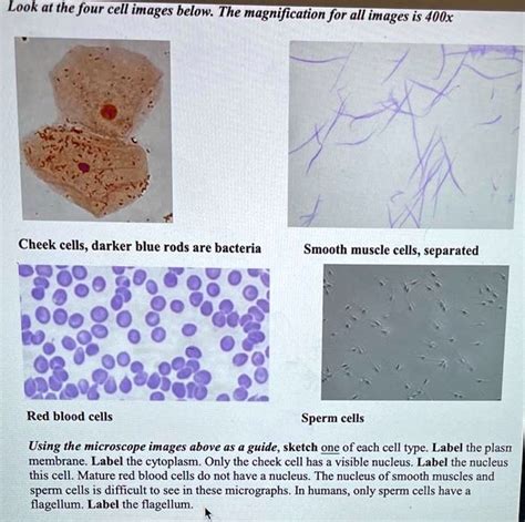 Look At The Four Cell Images Below The Magniication For All Limages 5 Is 400x Cheek Cells Darker