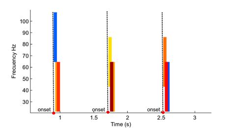 Time Frequency Representation Of A Normal Heart Sound Obtained With The