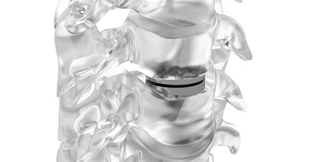 Neuro Dynalis C Cervical Disk Prosthesis