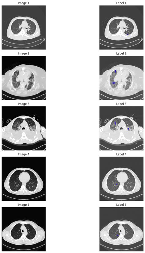 Deep Learning Approaches In Medical Image Segmentation KDnuggets