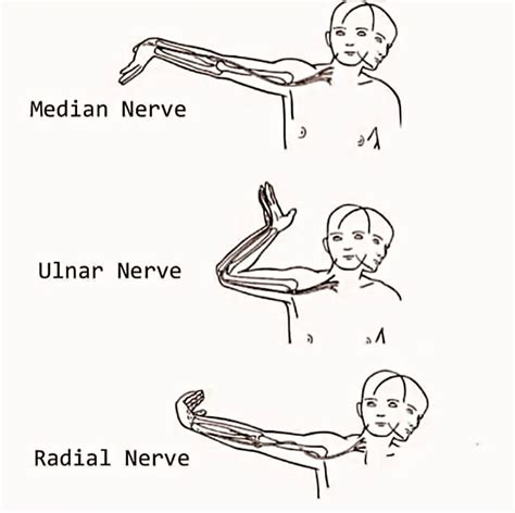 Quick Nerve Tension Tests For The Upper Limb A Median Nerve Arm Extended With Palm Up 1