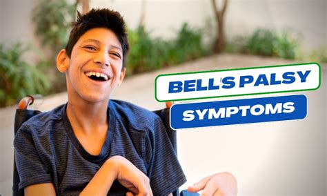 Bells Palsy Symptoms Causes And Self Care Measures Pmri Homoeo Hall