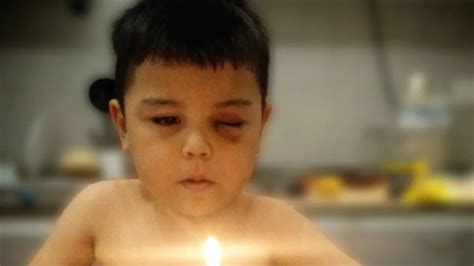 Todos Por Marcos” La Campaña Solidaria Para Ayudar A Un Nene De 4