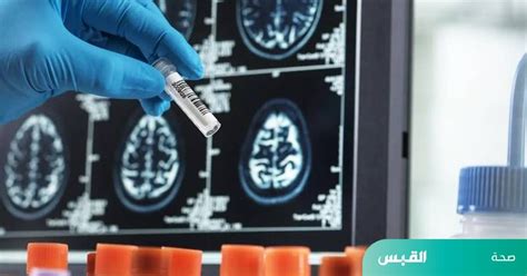 اختبار دم يتنبأ بالخرف قبل الإصابة بـ 15 عاماً