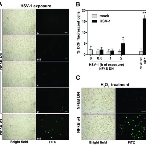 Ros Production In U937 Cells Exposed To Hsv 1 Cells Were Preloaded