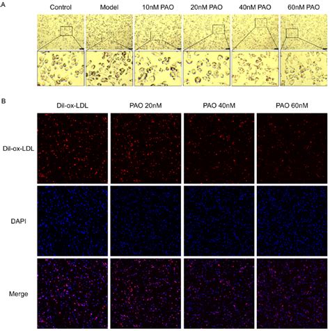 Effects Of Pao On Ox Ldl Induced Intracellular Lipid Droplets And