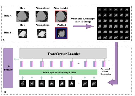 Tumour Image Processing And Feature Generation A Tumour Images