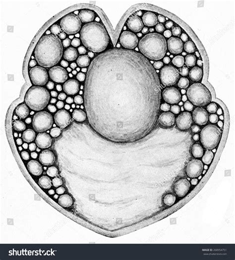 Hydatid Cyst Showing Daughter Cysts Vintage Stock Illustration 268954751