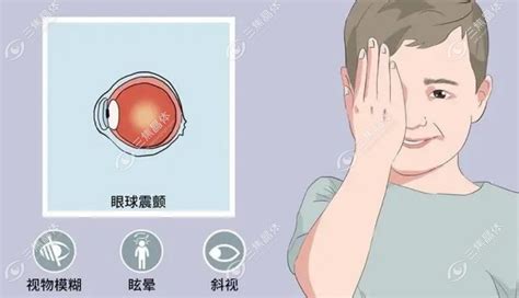 眼球震颤可以做晶体植入近视手术吗 可以 但飞秒激光不建议 近视 三焦晶体网