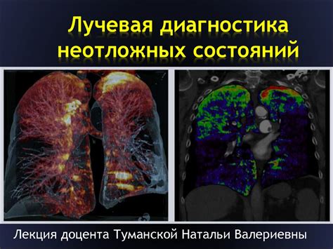 Лучевая диагностика неотложных состояний презентация онлайн