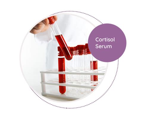 Cortisol Serum Mediscan Lab
