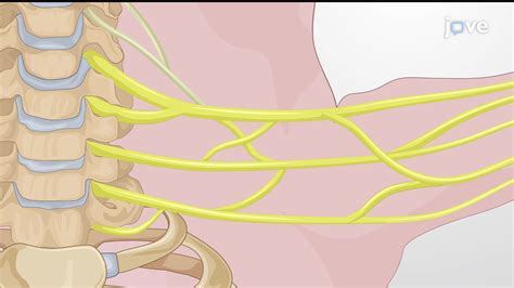 Plexus Choroideus Schafgehirn