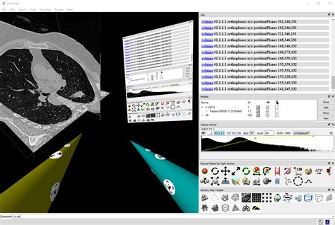 chimerax tutorial dicom in virtual reality