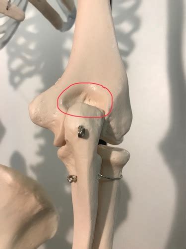 Anatomy Of The Upper Limb Labelling Flashcards Quizlet