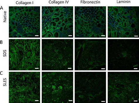 Immunofluorescence Staining For Ecm Protein Components Collagen I