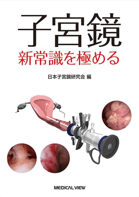 メジカルビュー社｜産婦人科・周産期医学｜子宮鏡 新常識を極める Web動画付