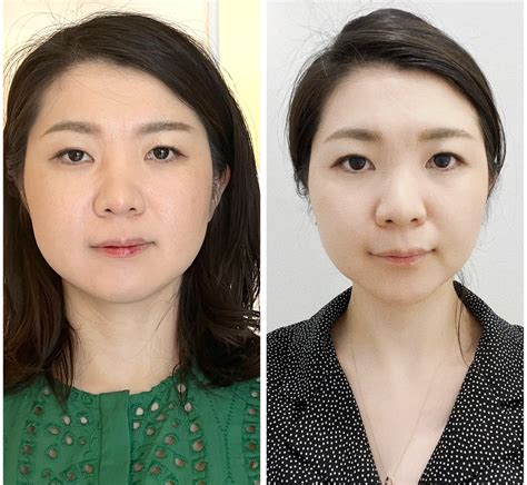 体重が増えていないのに顔が大きくなってきた 小顔美容整体サロン シエルブルー 代々木新宿