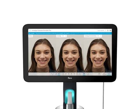 Align Technology Introduces Invisalign Smile Architect With Multiple