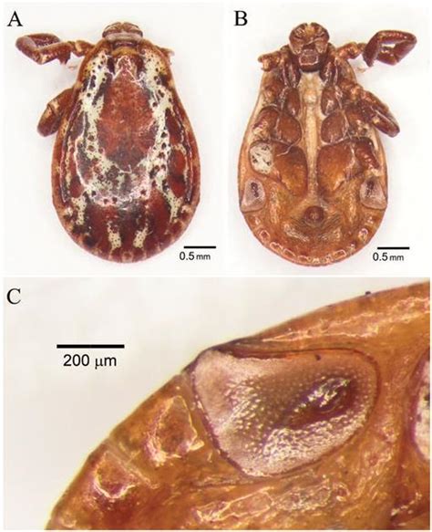Dermacentor Variabilis Anatomy