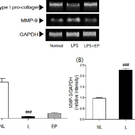 Effects Of EP On The Expressions Of Type I Pro Collagen And MMP 9 In