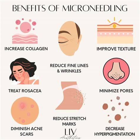 Benefits Of Microneedling Skin Aesthetics Skin Care Business Skin Facts