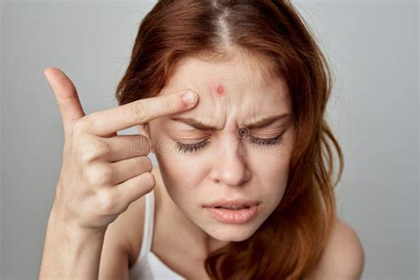 Woman Squeezes Pimple On Her Forehead Skin Problems Cosmetology Stock