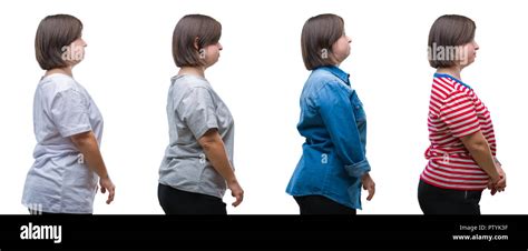Collage Of Down Sydrome Woman Over Isolated Background Looking To Side