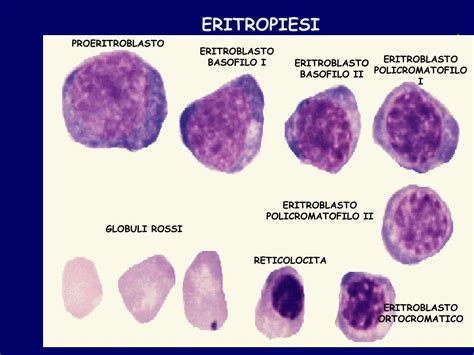 Ppt Ematologia Pediatrica Powerpoint Presentation Free Download Id