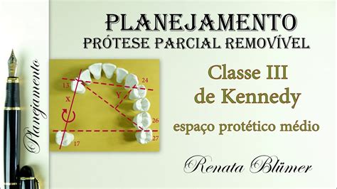 Ppr Planejamento Classe Iii De Kennedy Médio Youtube