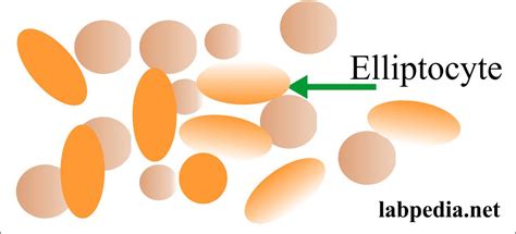 Elliptocyte