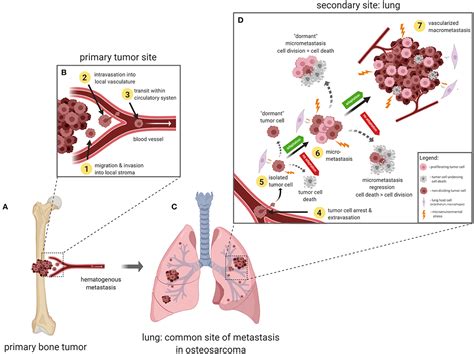 Metastasis Diagram